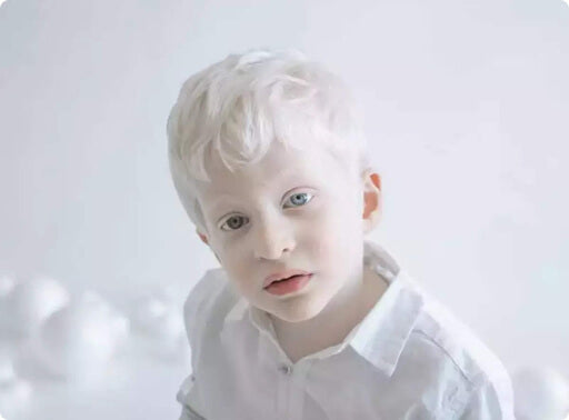 Effective Skin Pigmentation & Acne Treatment solutions